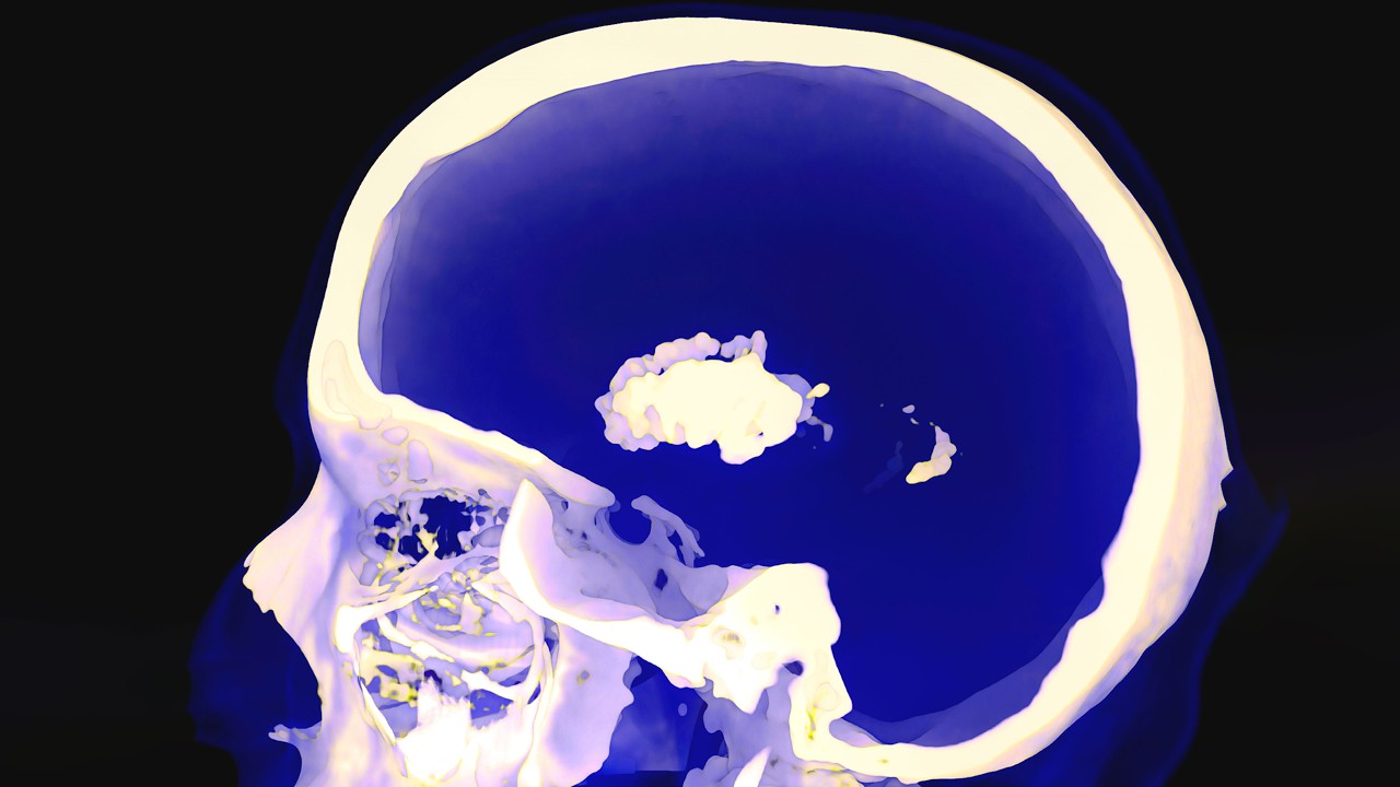 How whipped cream propellant nearly killed a TikToker
