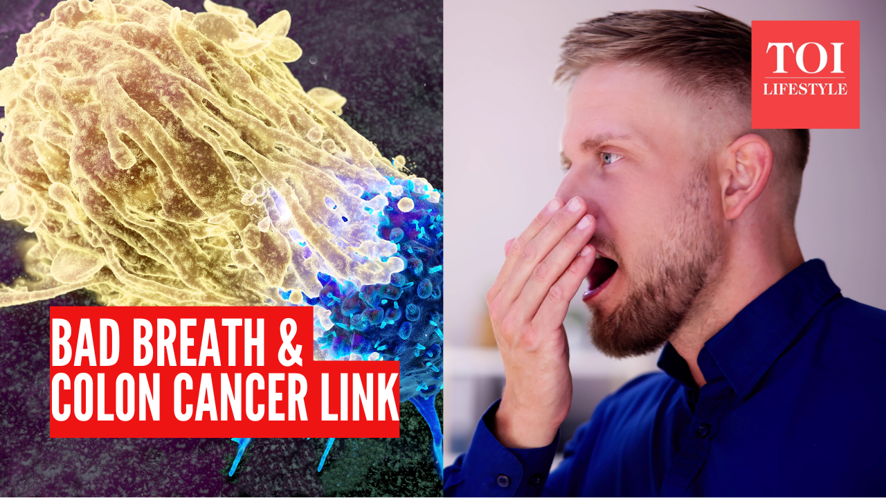 Persistent bad breath could be a warning sign of colon cancer ...