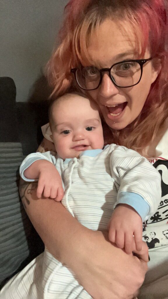 Baby’s wide eyes sign of syndrome so rare it doesn’t have a name