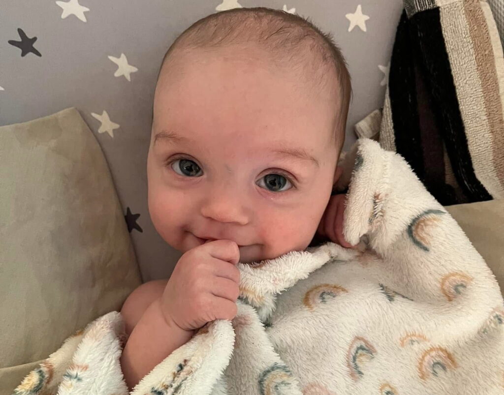 Baby’s wide eyes sign of syndrome so rare it doesn’t have a name