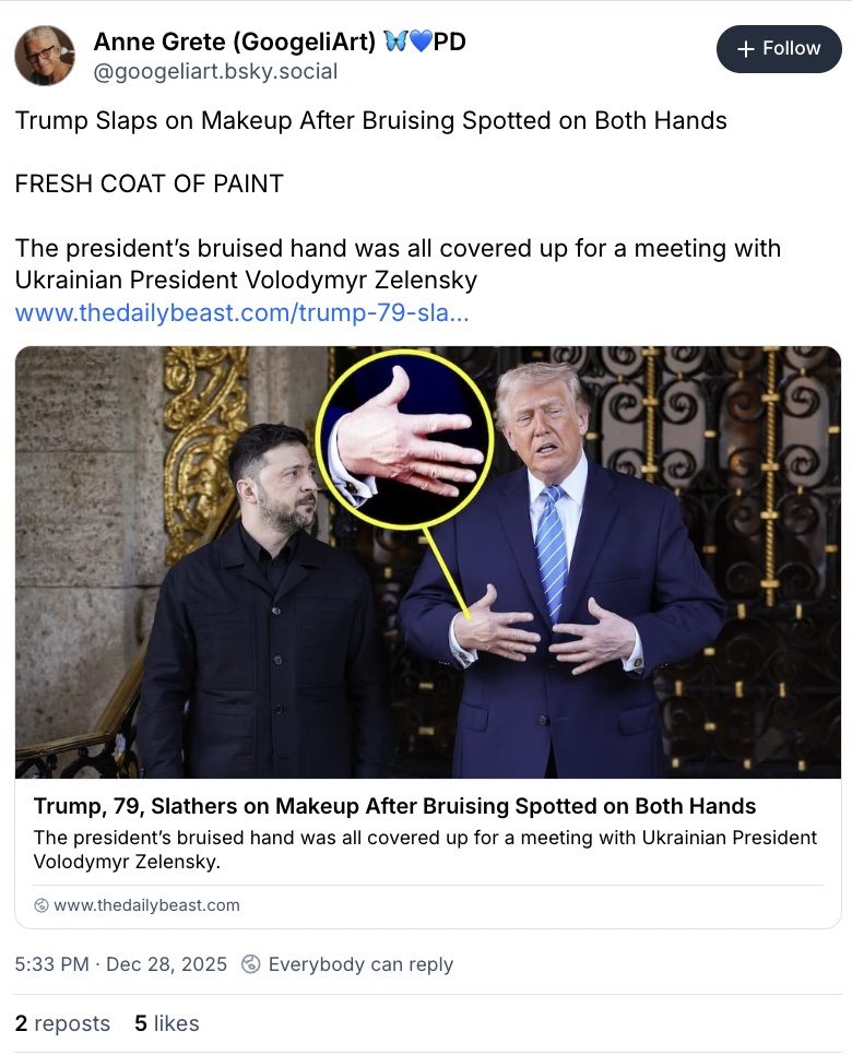 Trump’s ‘painted’ hands spark social media speculation after Mar-a-Lago ...