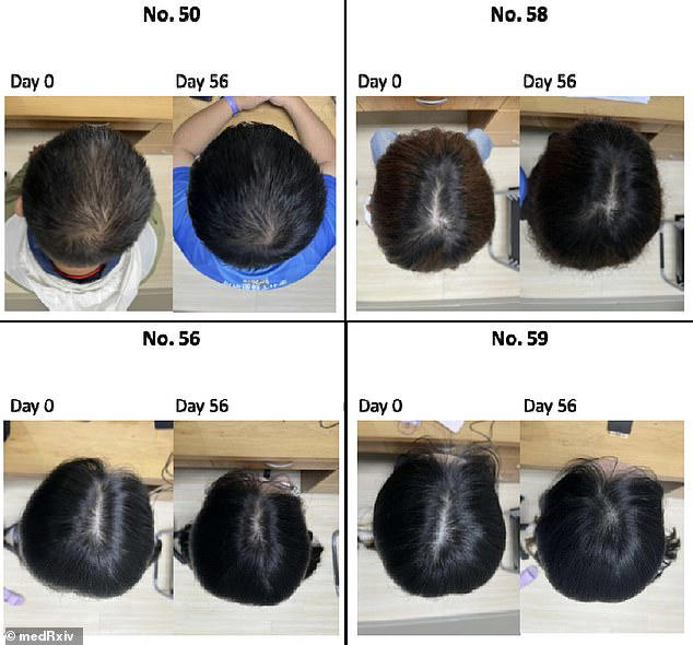 Common tropical plant doubles hair growth and thickness in less than ...