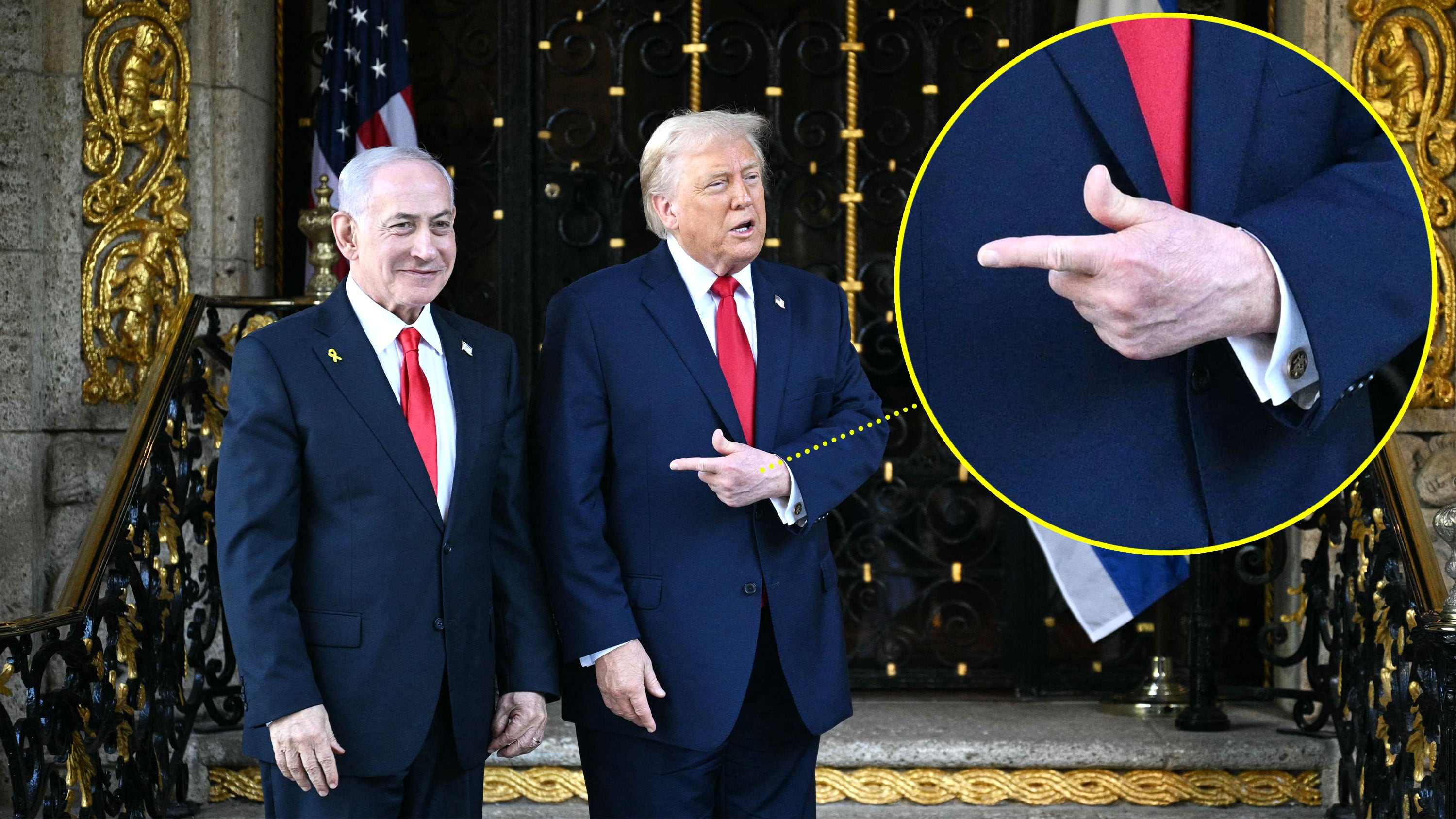 Trump, 79, doesn’t even try to cover up bruising on ‘good’ hand