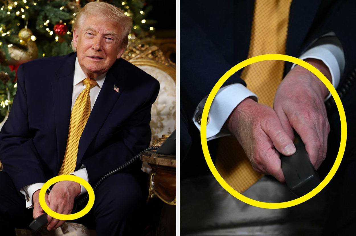 People are making brand new observations about Trump's hands
