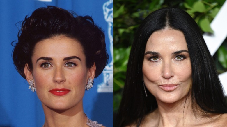 Side-by-side pics make Demi Moore's face transformation undeniable