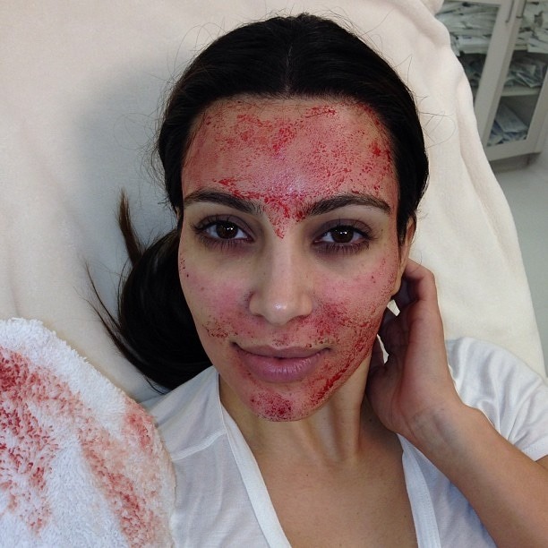 5 crazy skincare treatments you forgot about, from the 'bird poop ...