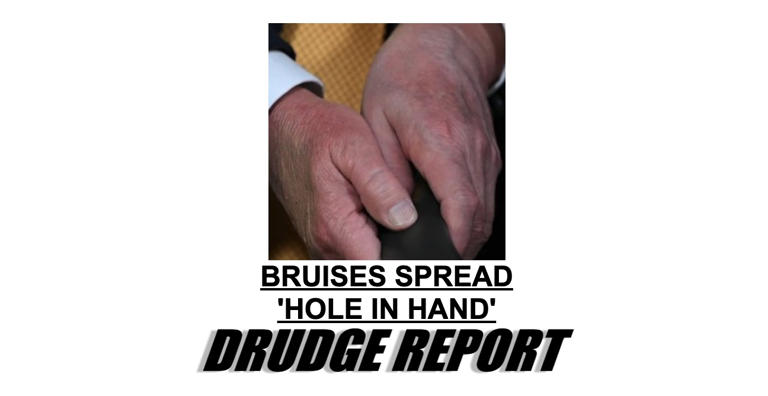 ‘Bruises spread’: Drudge Report highlights alarming stories on Trump’s ...
