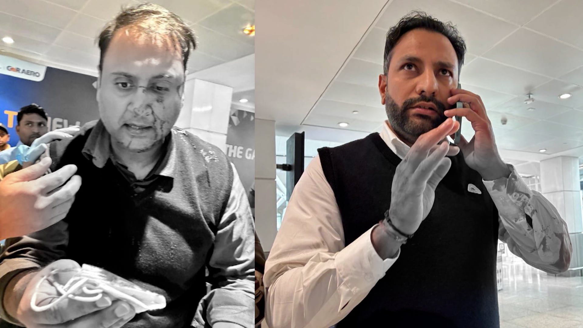 "Shaken my trust": Man thrashed by pilot at Delhi airport to NDTV