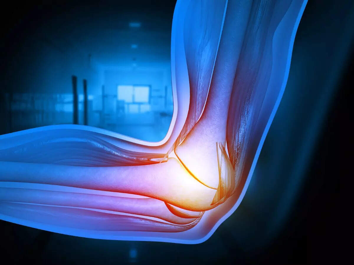 6 foods that support tendon health