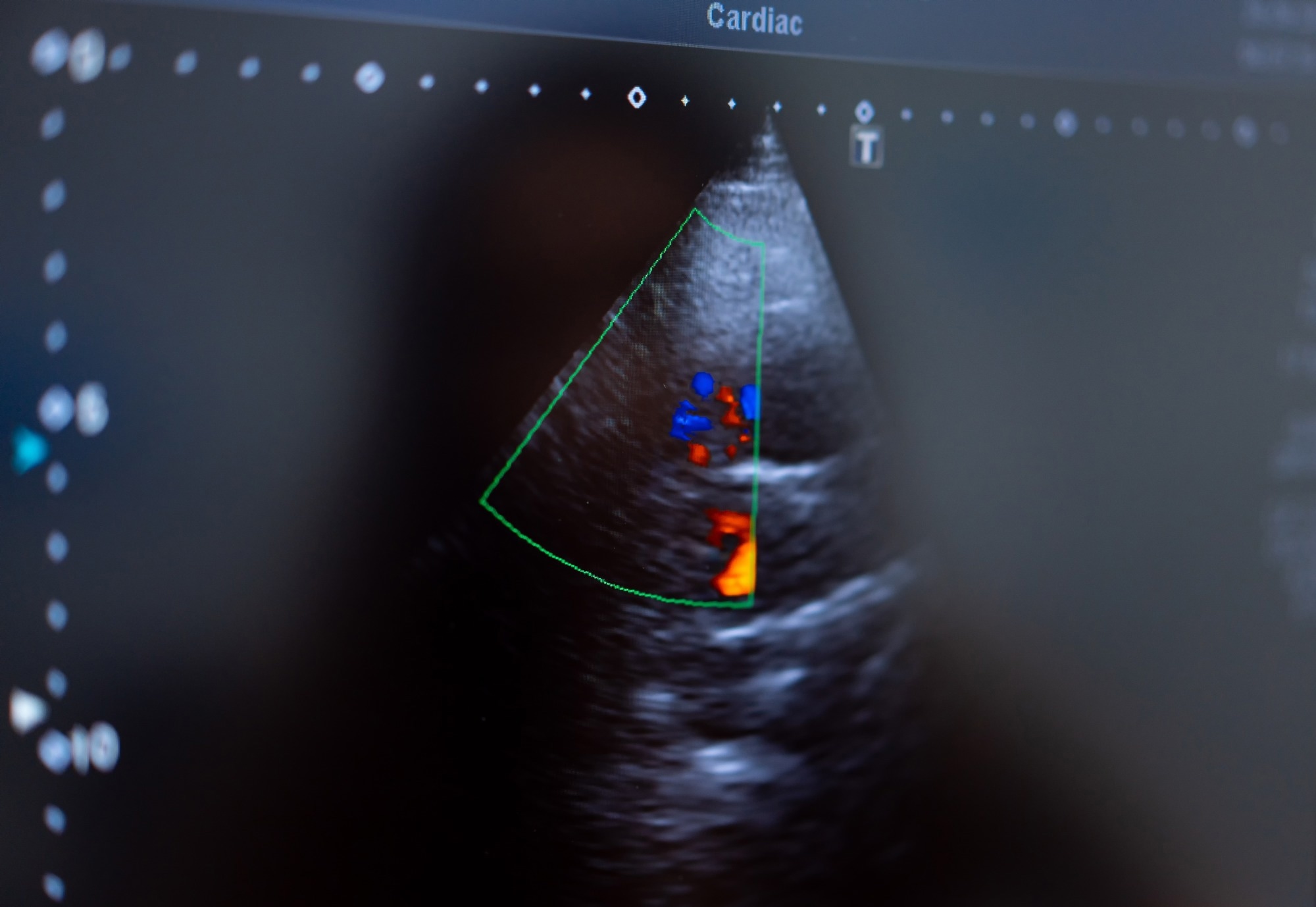 AI can design heart disease treatments using imaging and biological data