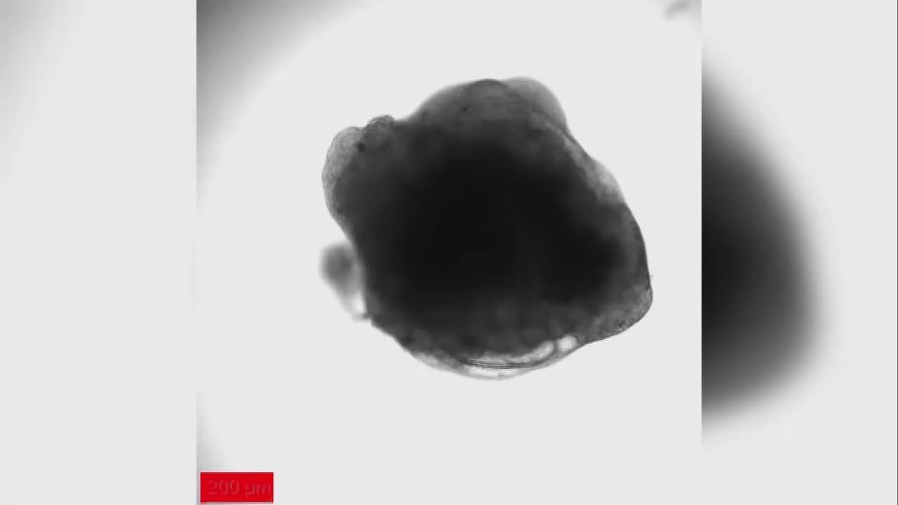 MSU researchers develop 'mini heart' to advance atrial fibrillation ...