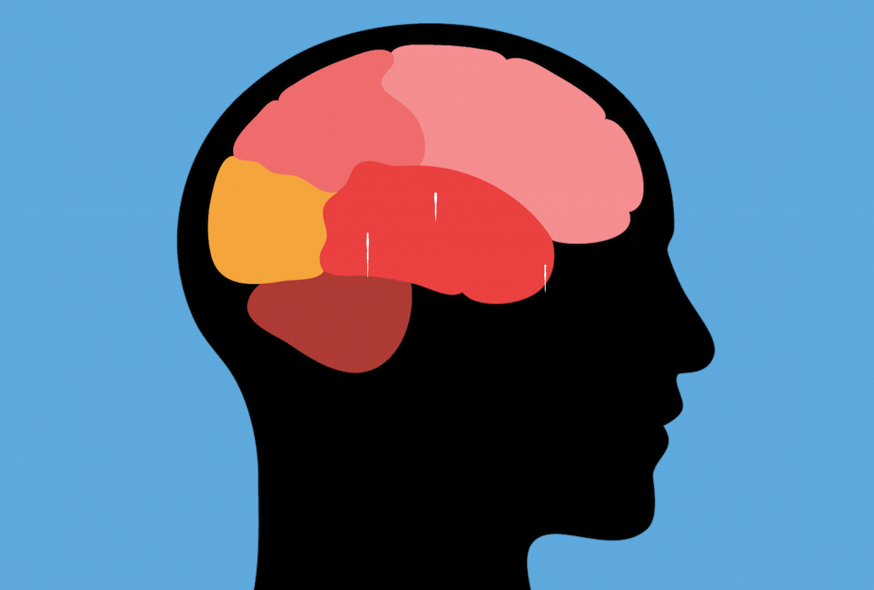 What happens to your brain when you eat too much sugar