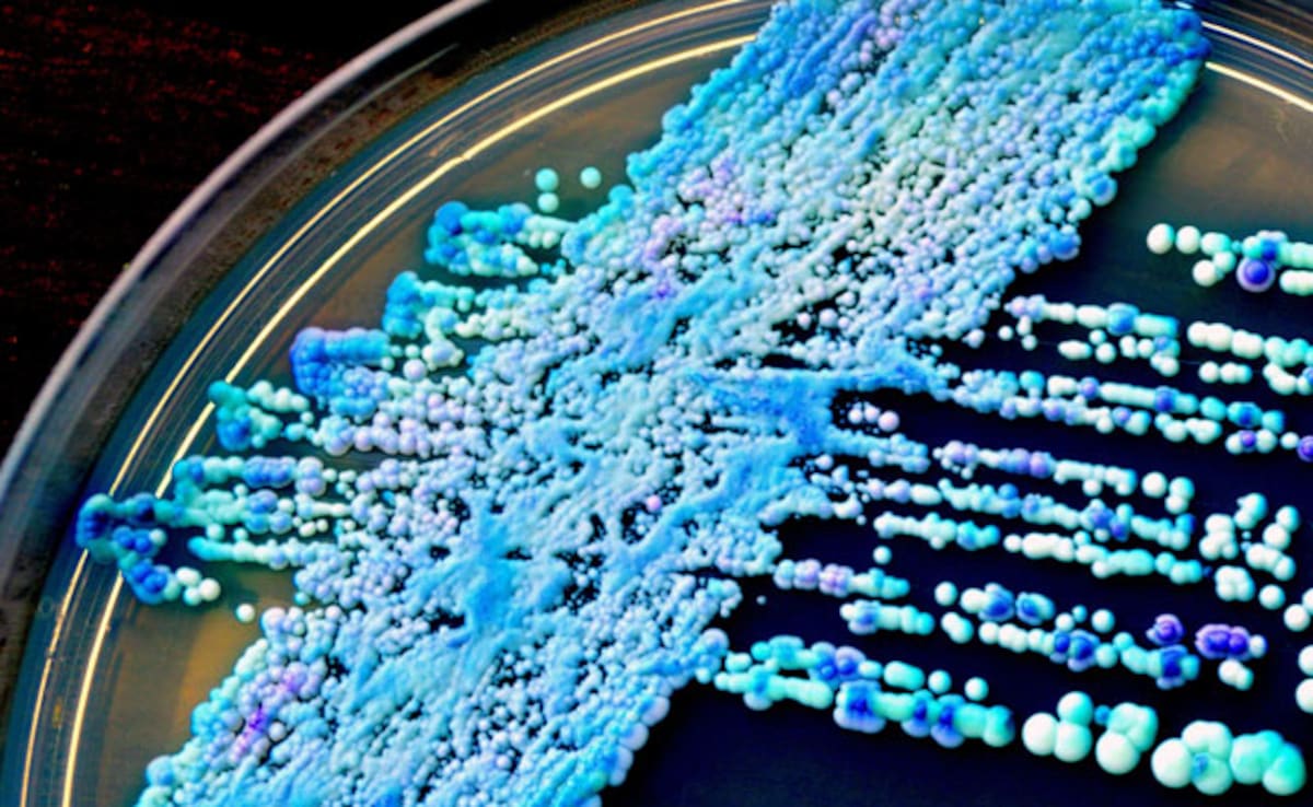 Deadly drug-resistant fungus spreading globally, says new Indian study