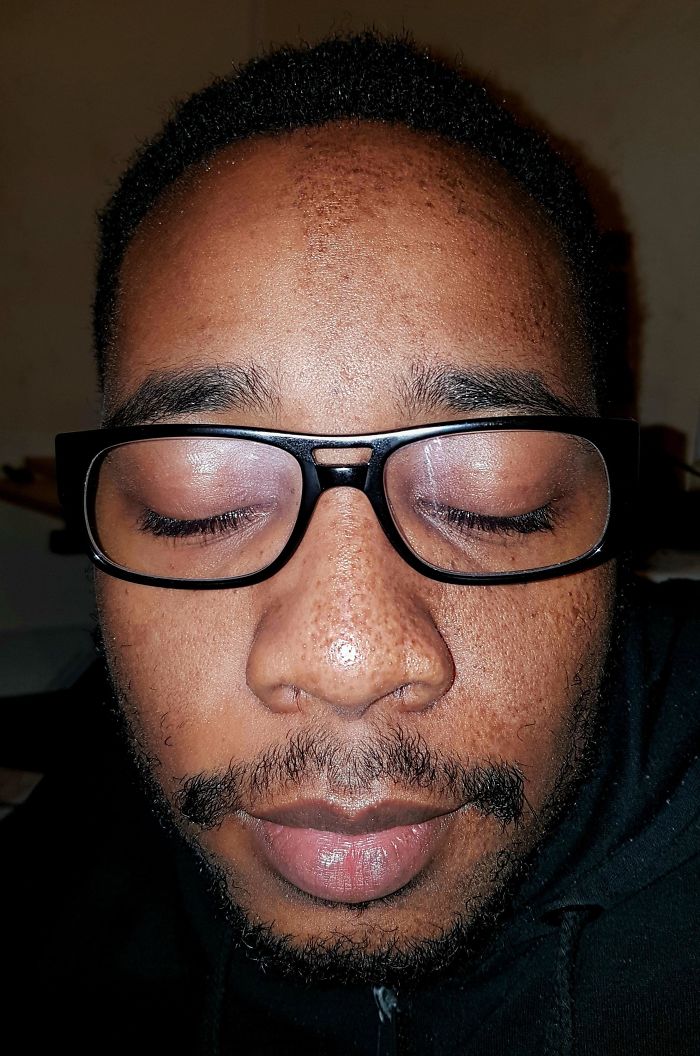 25 people whose genetics made them unique