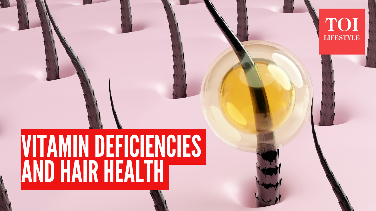 5 vitamin deficiencies that are linked to poor hair growth and food ...