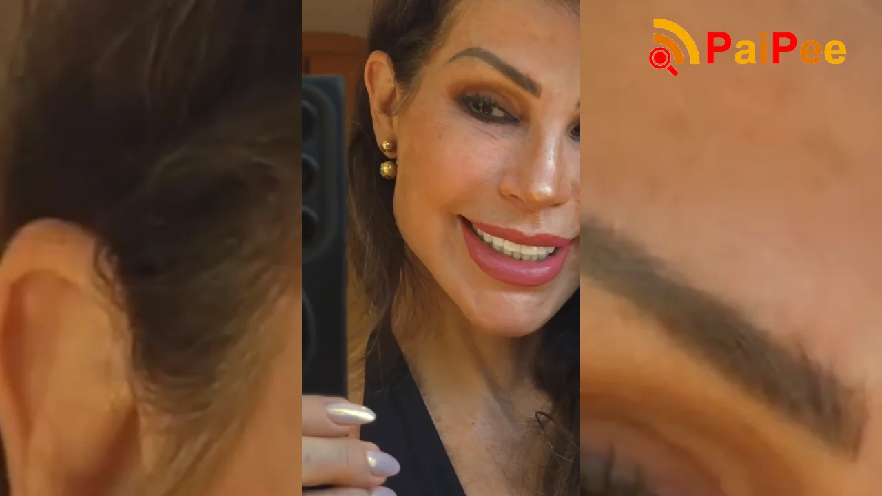 Eliane Morato mostra antes e depois de “deep plane” aos 66 anos