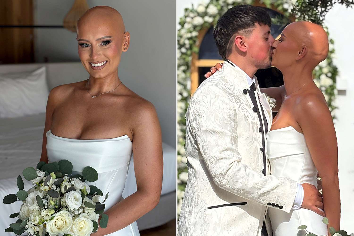 Woman with alopecia says not wearing a wig on wedding day gave her ...