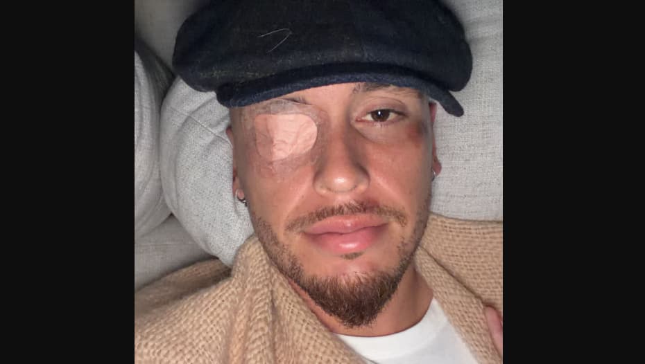 L'ancien joueur de l'OM Lucas Ocampos victime d'une paralysie faciale