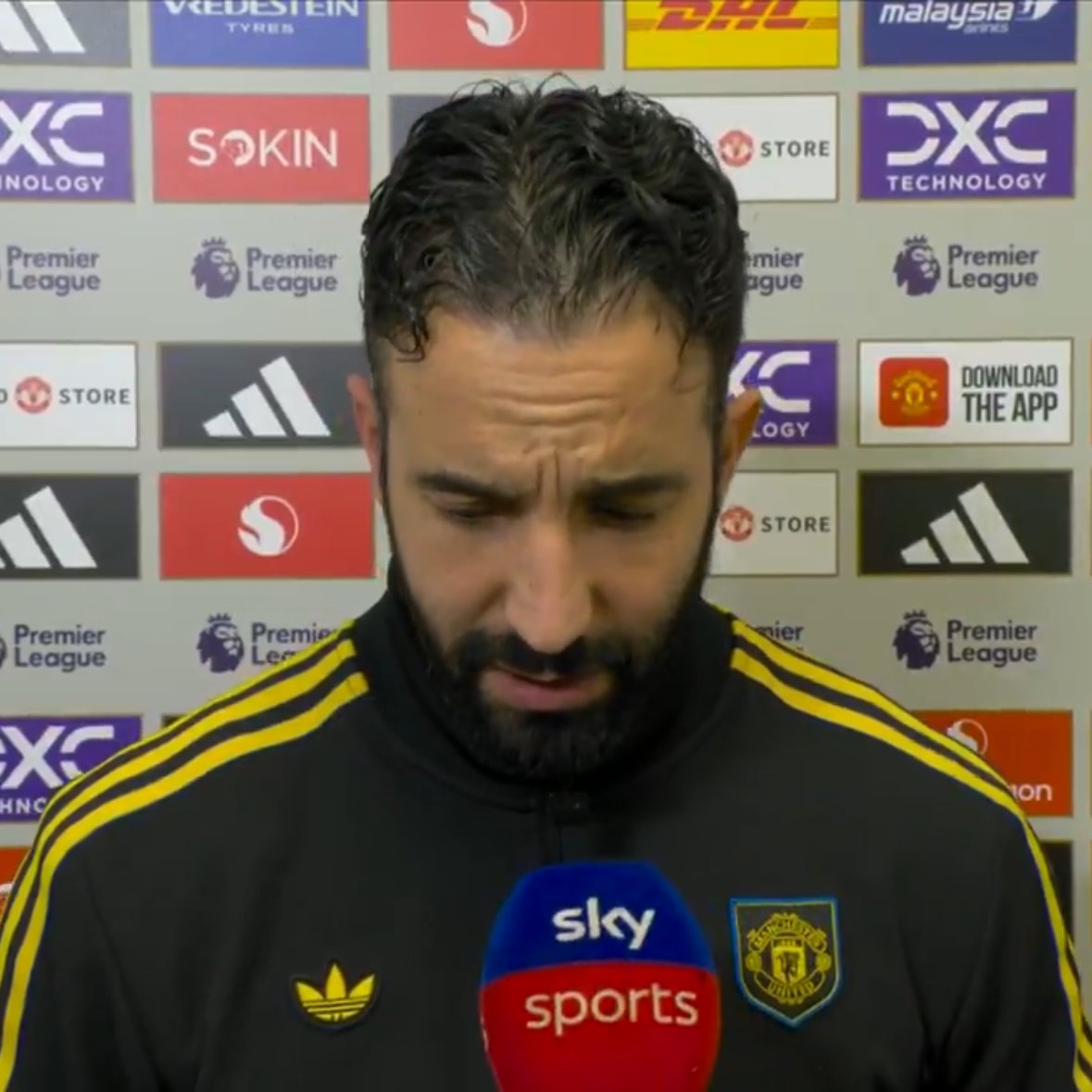 Manchester United confirm 'small' injury setback with eight players ...