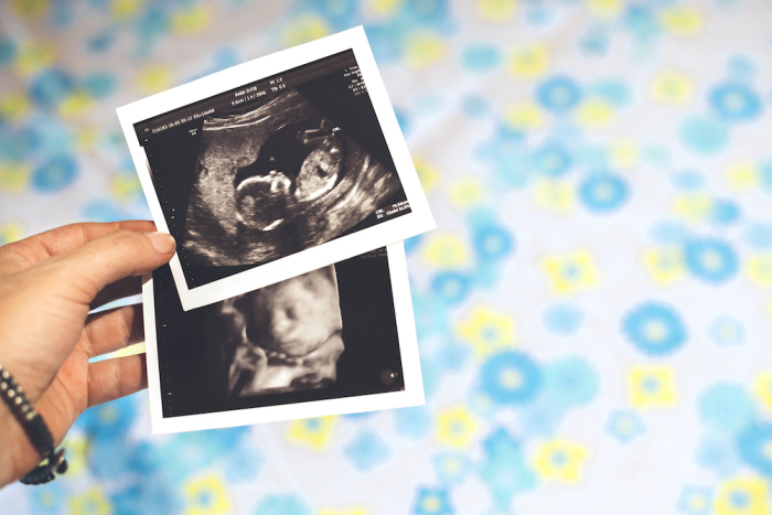 'Landmark achievement': New Puerto Rico law recognizes unborn children ...