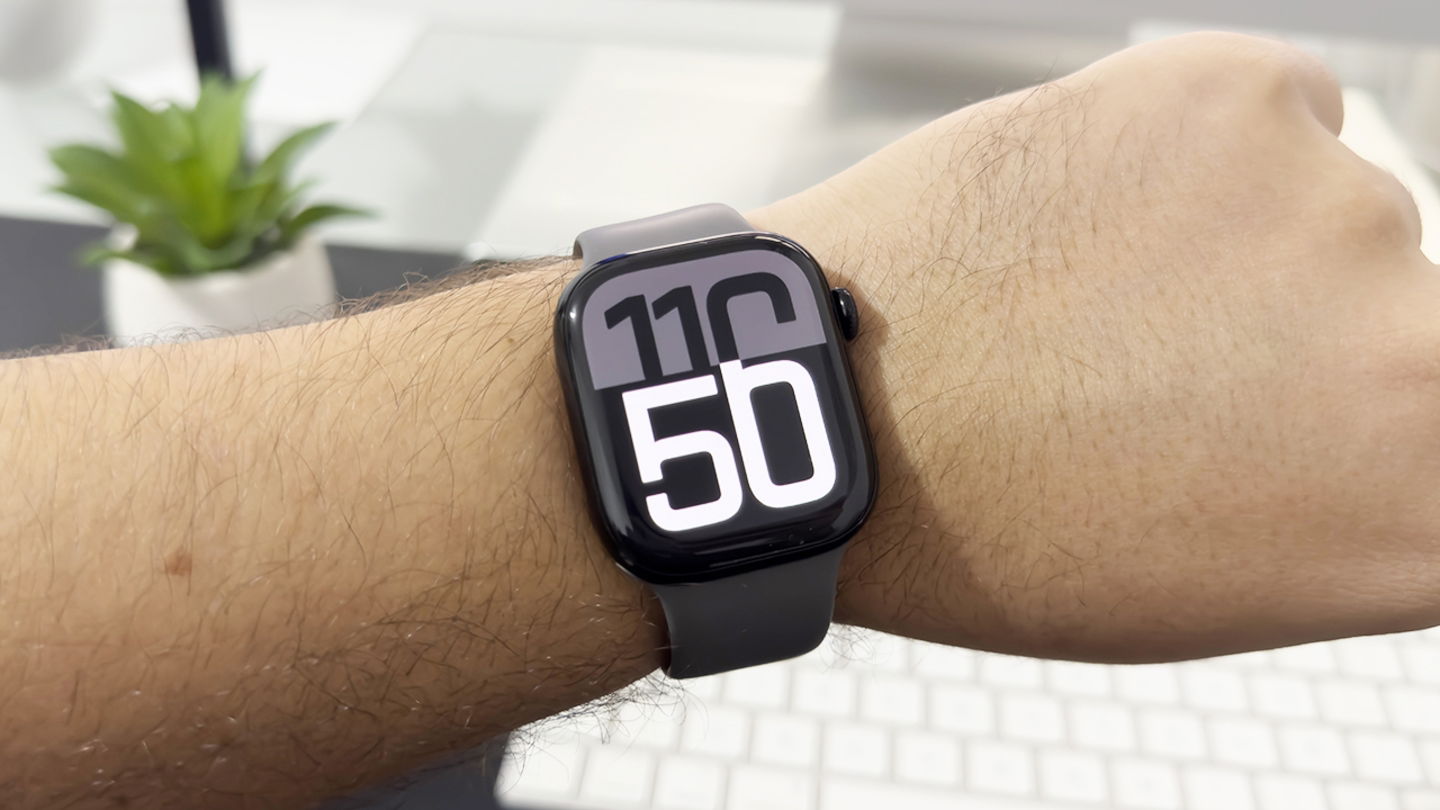 El Apple Watch Series 11, con su espectacular y delgado diseño, tiene ...