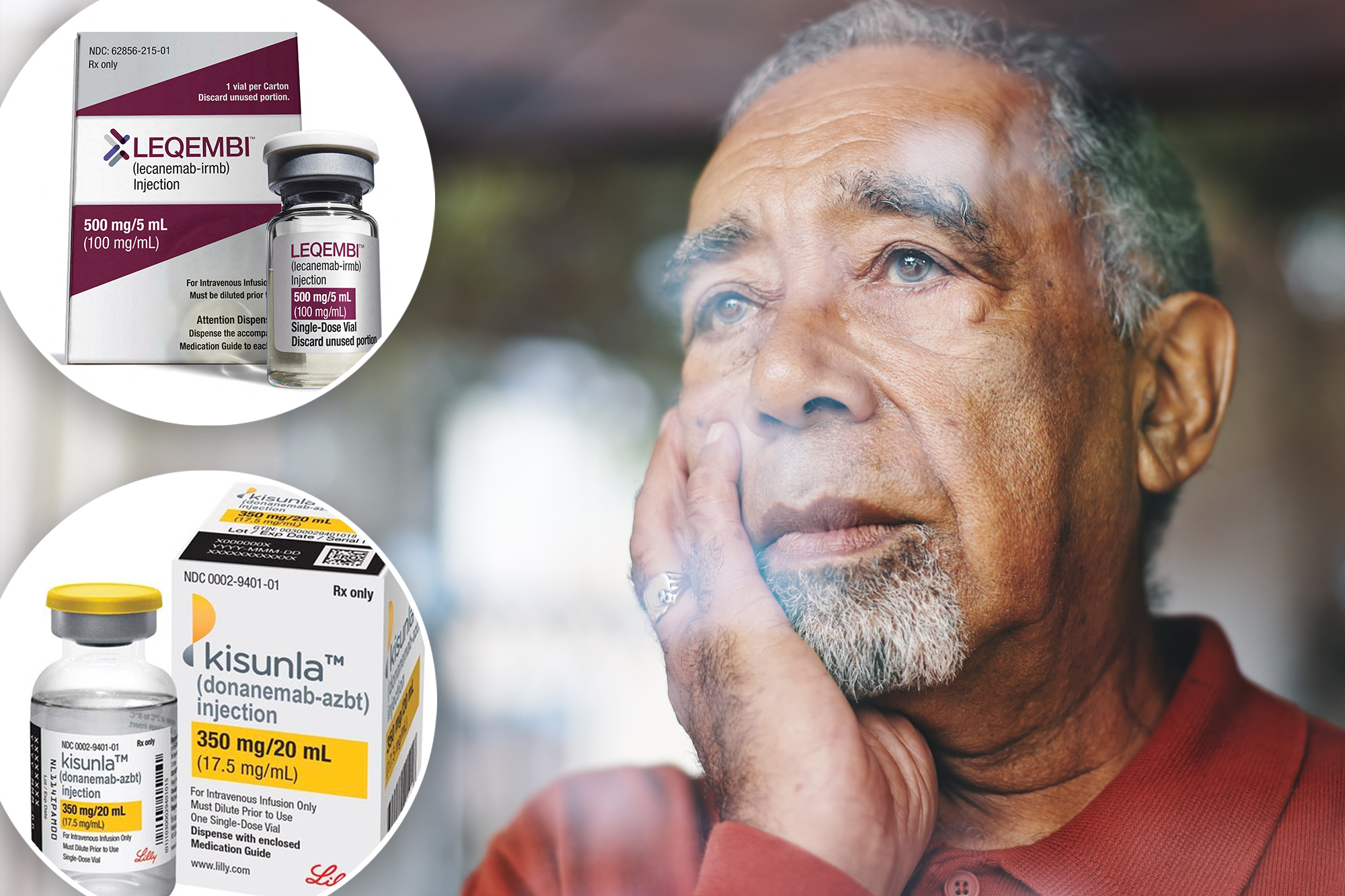 These groundbreaking Alzheimer’s drugs slow brain decline by treating ...