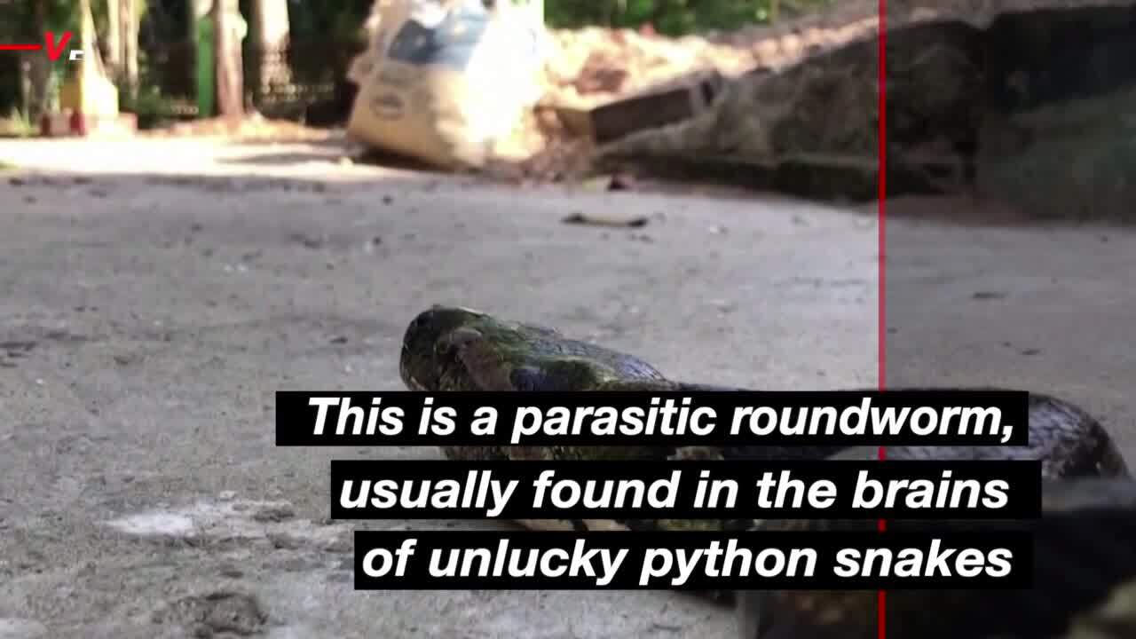 A live parasitic worm was surgically removed from a woman’s brain — and ...