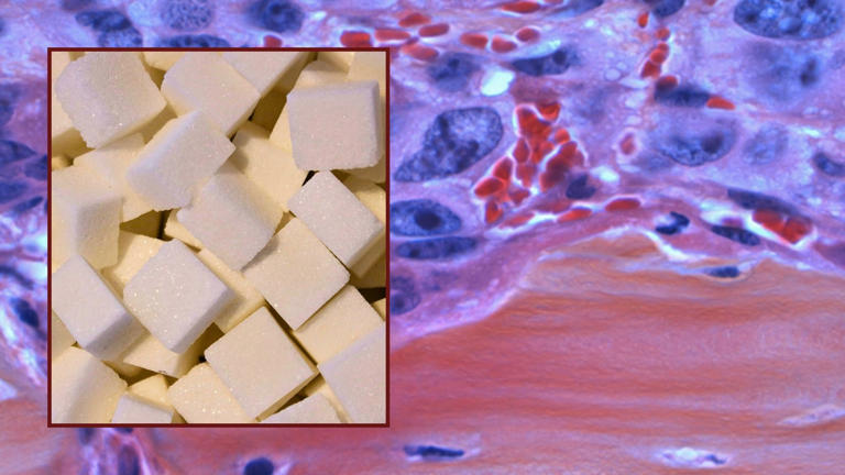 Sugars found in the ocean can trigger cancer cells to self-destruct ...