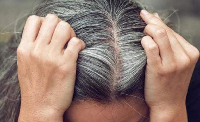 Dermatologist suggests diet changes can reverse grey hair; best foods ...