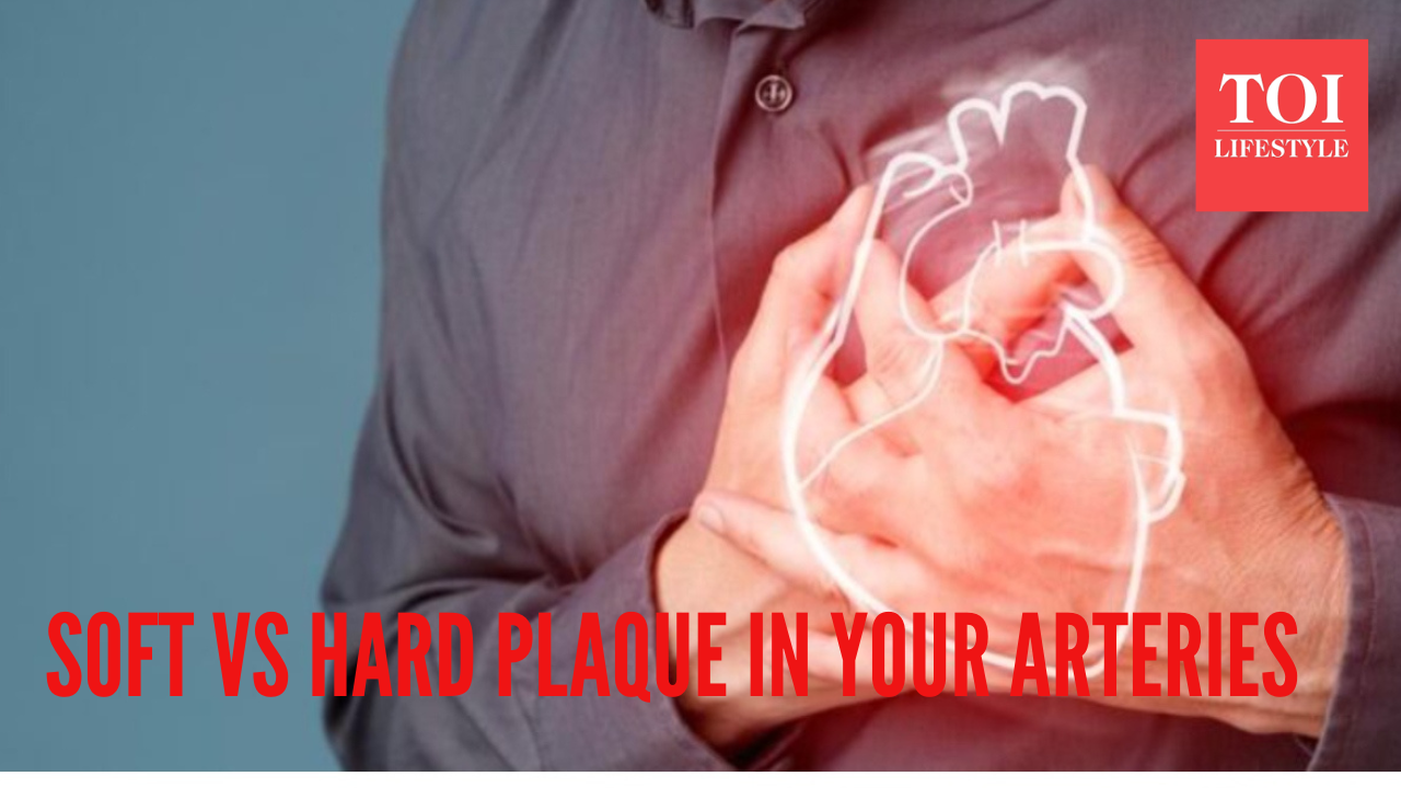 Soft vs. hard plaque in your arteries: Leading cardiologist explains ...