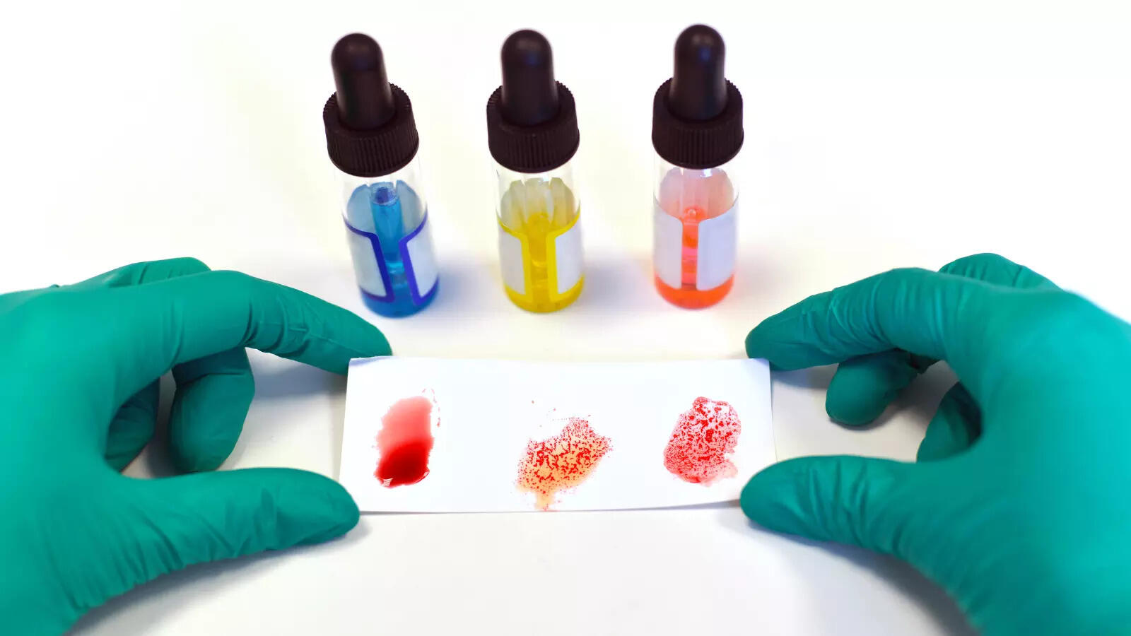 Understanding the importance of the TORCH test during pregnancy