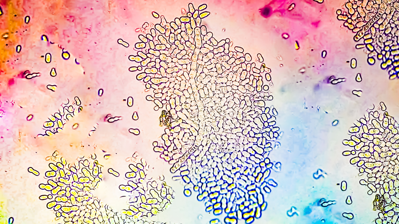 What is candida auris infection? The deadly superbug spreading in US