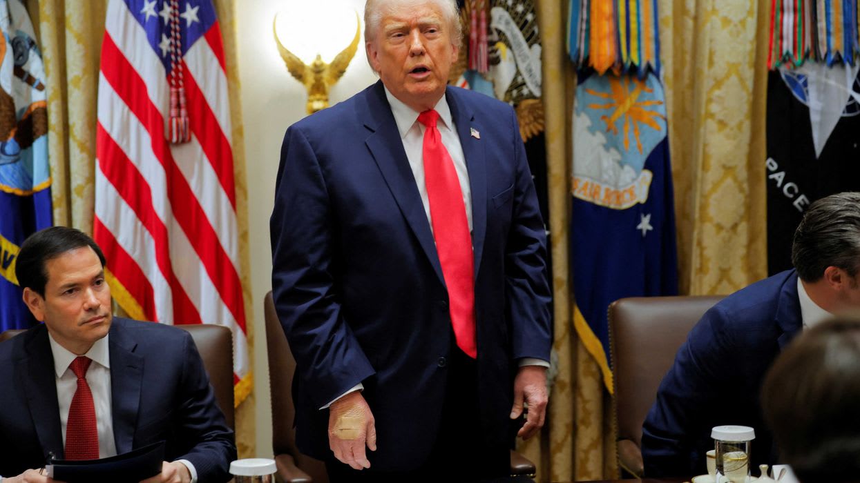 Trump's explanation for bruising on hands fuels more questions