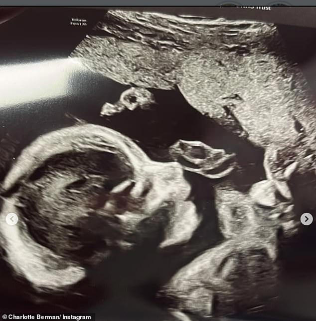 The Traitors star Charlotte Berman is pregnant after sharing fertility ...