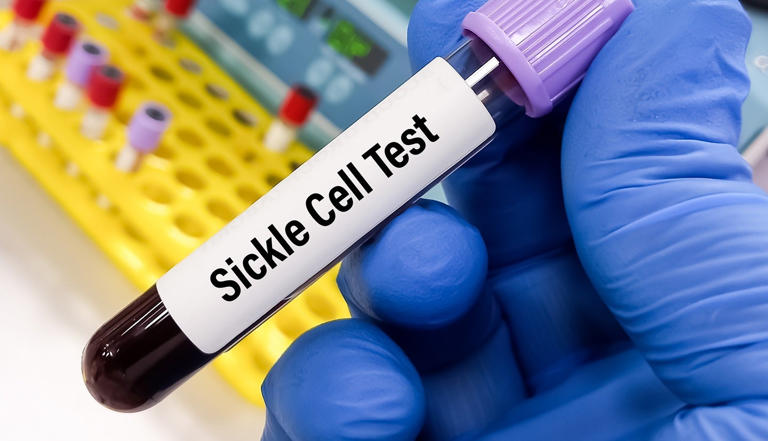 Emmaus, NIT sign Endari distribution agreement