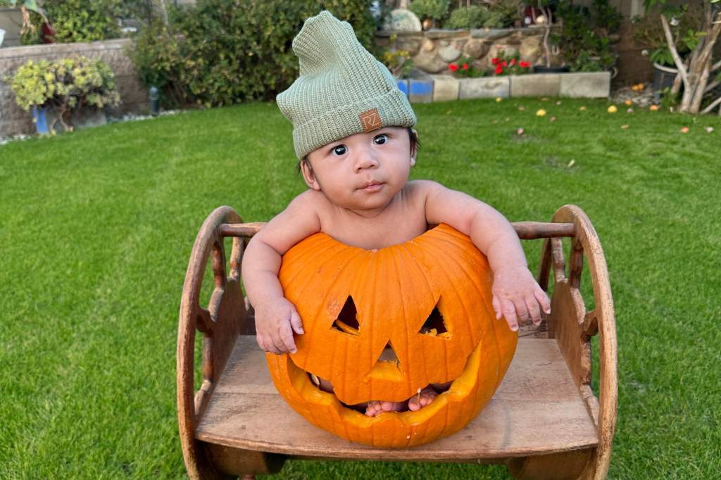 California baby born after extremely rare pregnancy, defies all odds