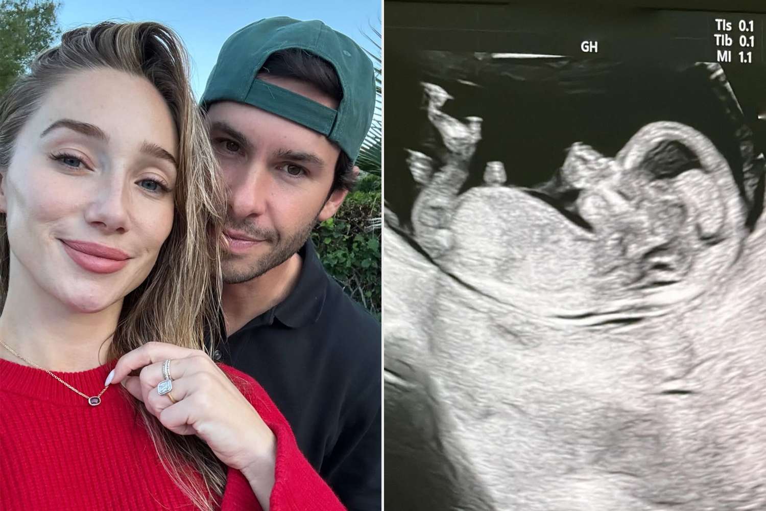 Aurora Culpo is pregnant and expecting baby no. 3, her first with ...