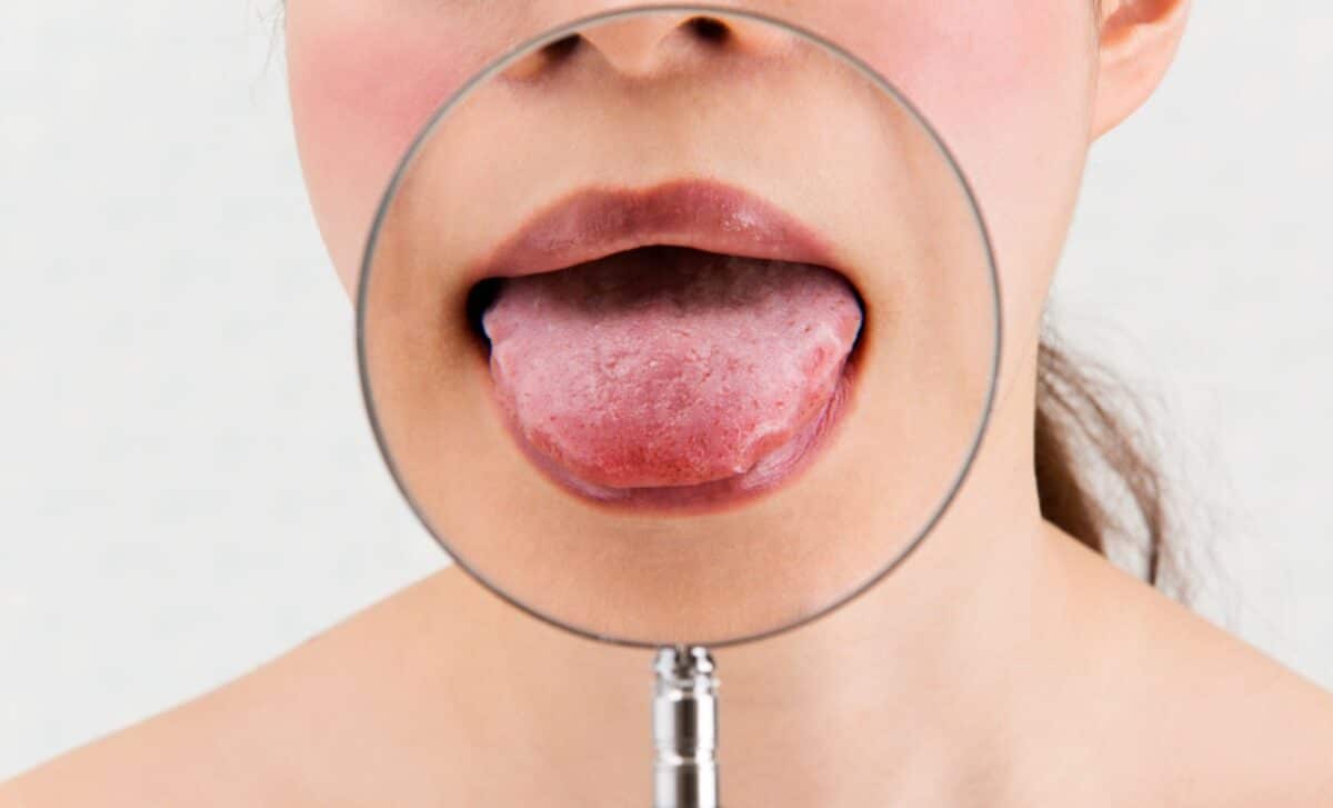 Weird taste in your mouth? These infections are often to blame