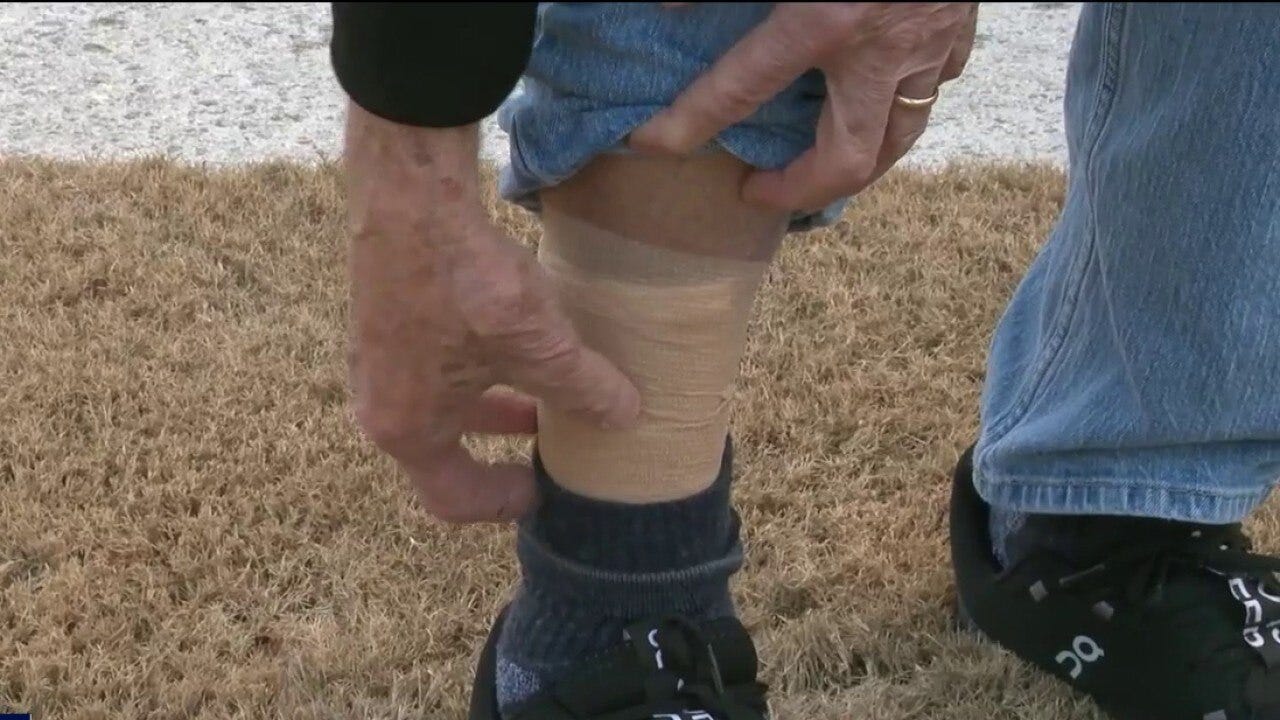 Rabid coyote bites man, pets in Buford