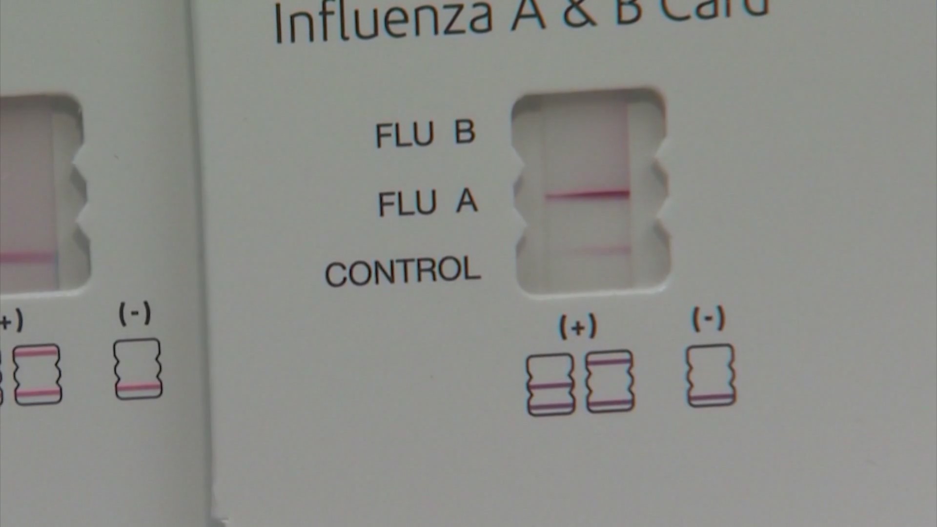 Flu cases, hospitalizations on the rise in Cook County and nationwide