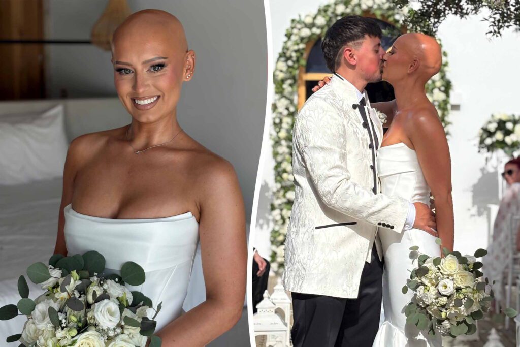 Bride with alopecia walks down aisle without wig to embrace natural look