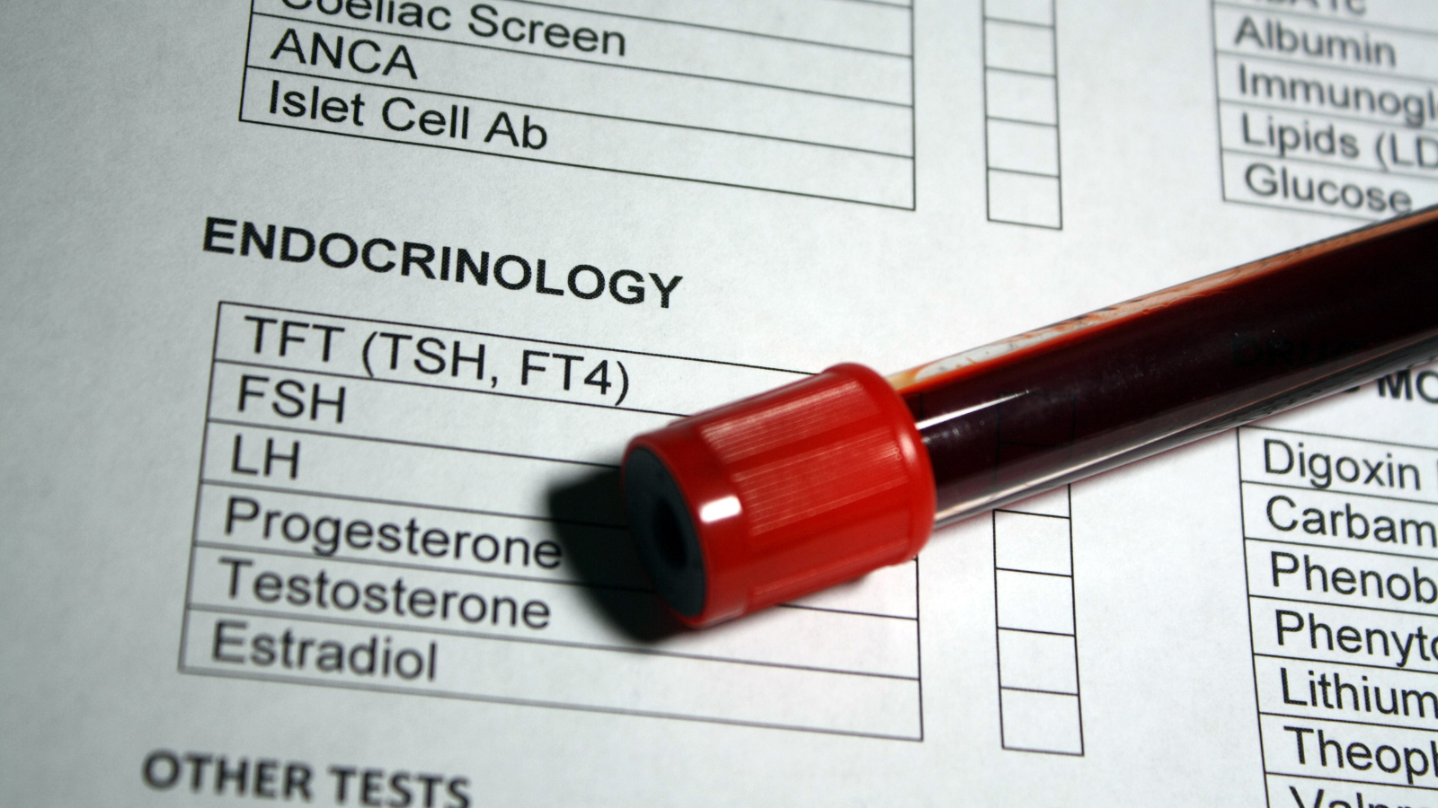 AMH, LH: FSH ratio, testosterone, insulin