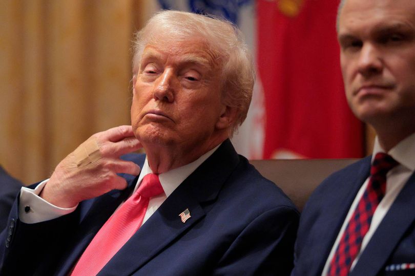 Trump's 5 concerning health bombshells - from bleeding confession to ...
