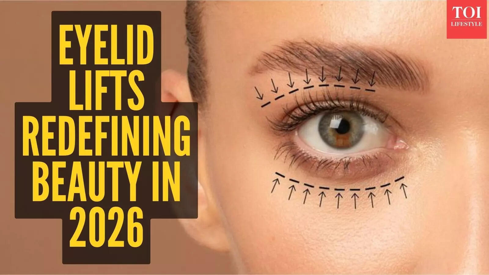 Eyelid lift in your 20s, 30s? Why blepharoplasty is hottest anti-ageing ...