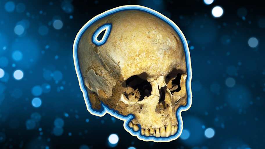 5 dangerous things that were once considered medicine – from mummy ...