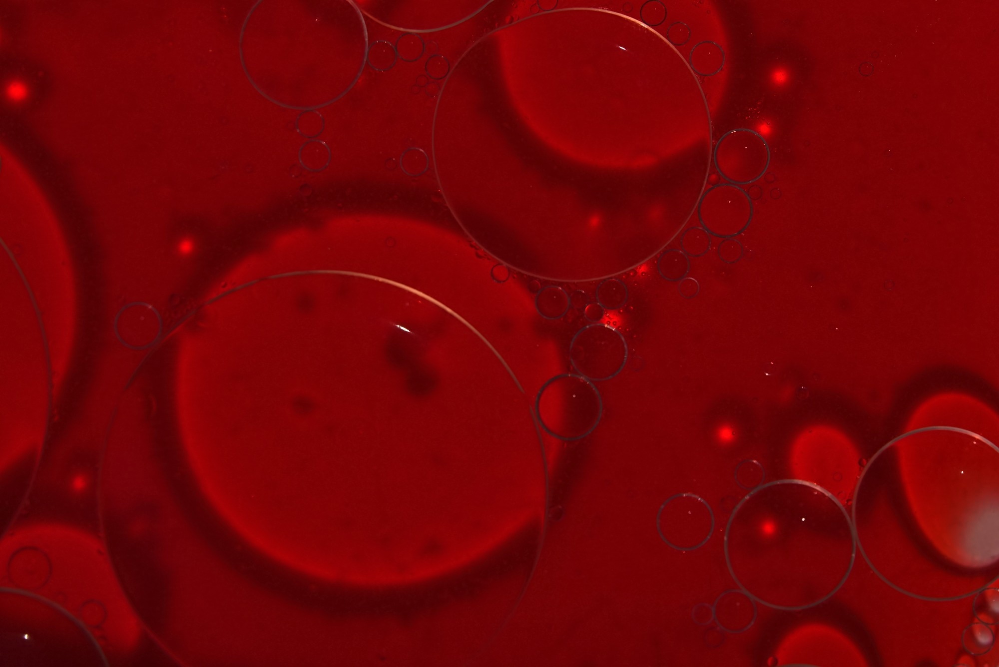 Small shifts in blood sodium may influence human brain excitability