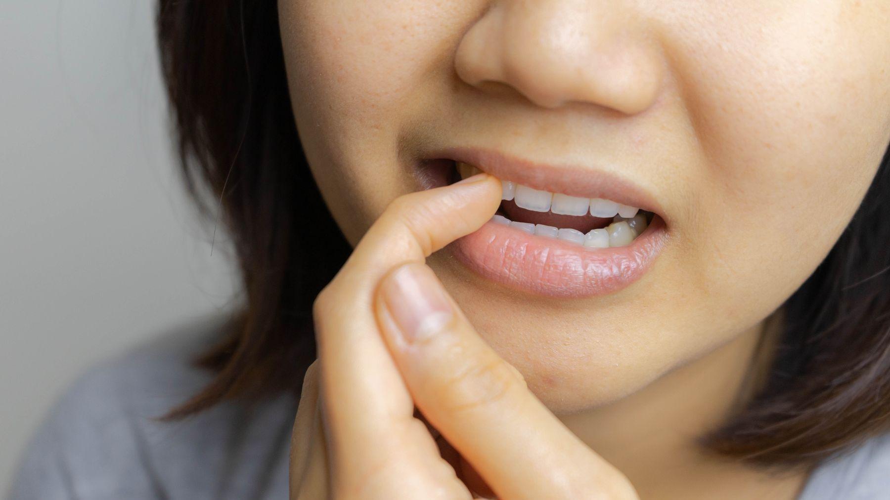 The foods dentists say are worst for your teeth