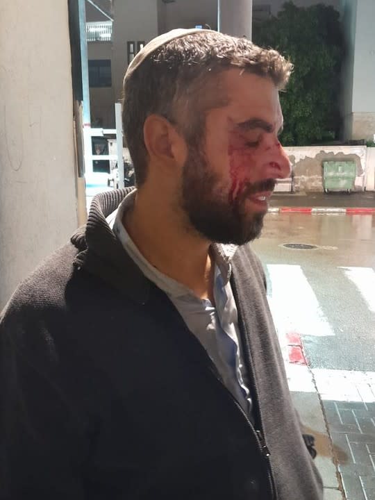 Rabbi attacked in Jaffa: Police investigating possible nationalist motive