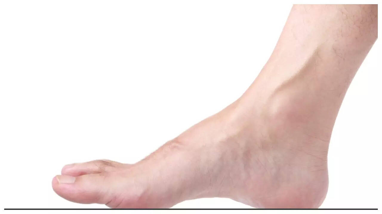 5 signs your legs can warn you about hidden diseases