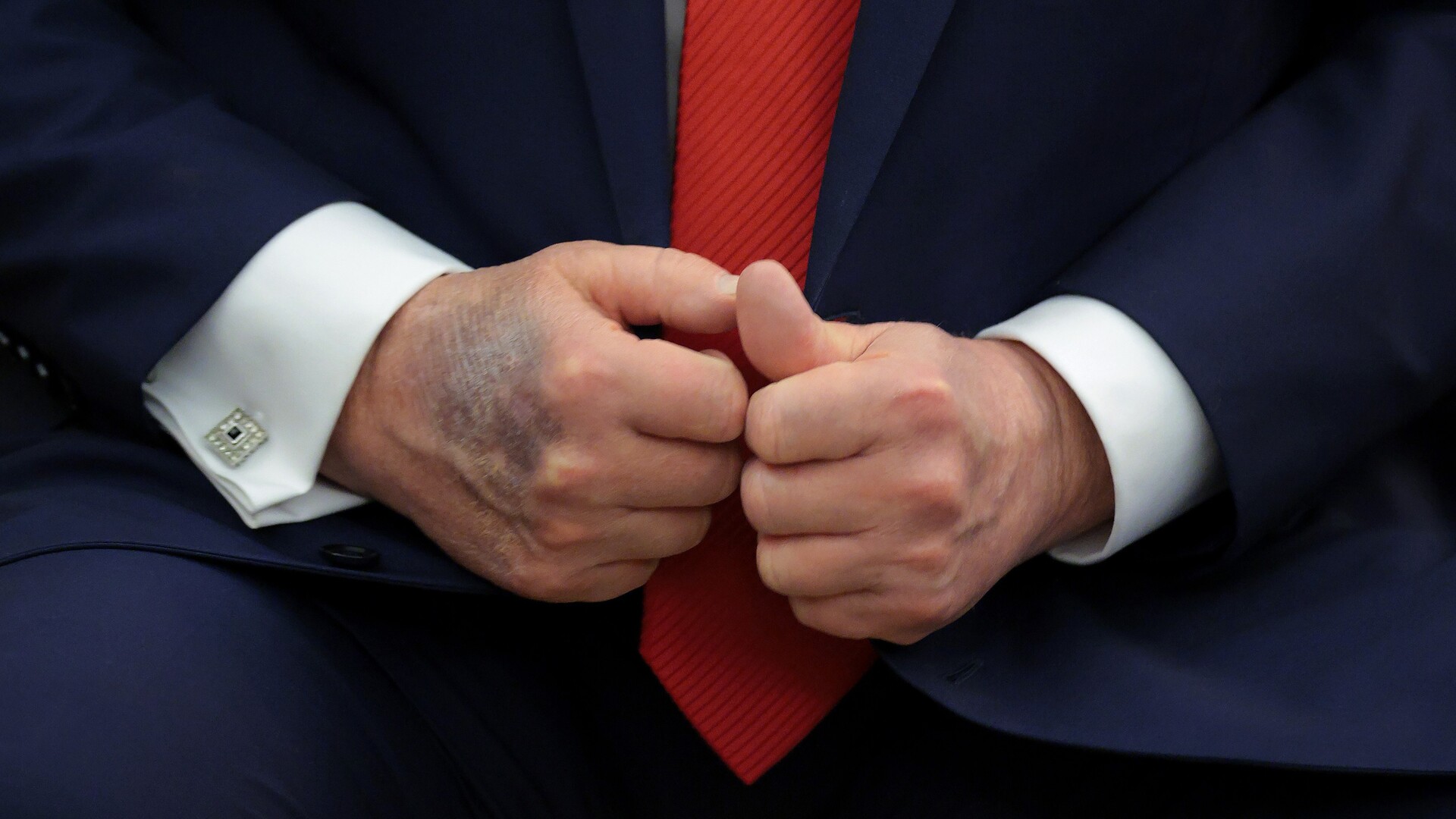 ‘I don't want thick blood’: Trump takes more aspirin than advised